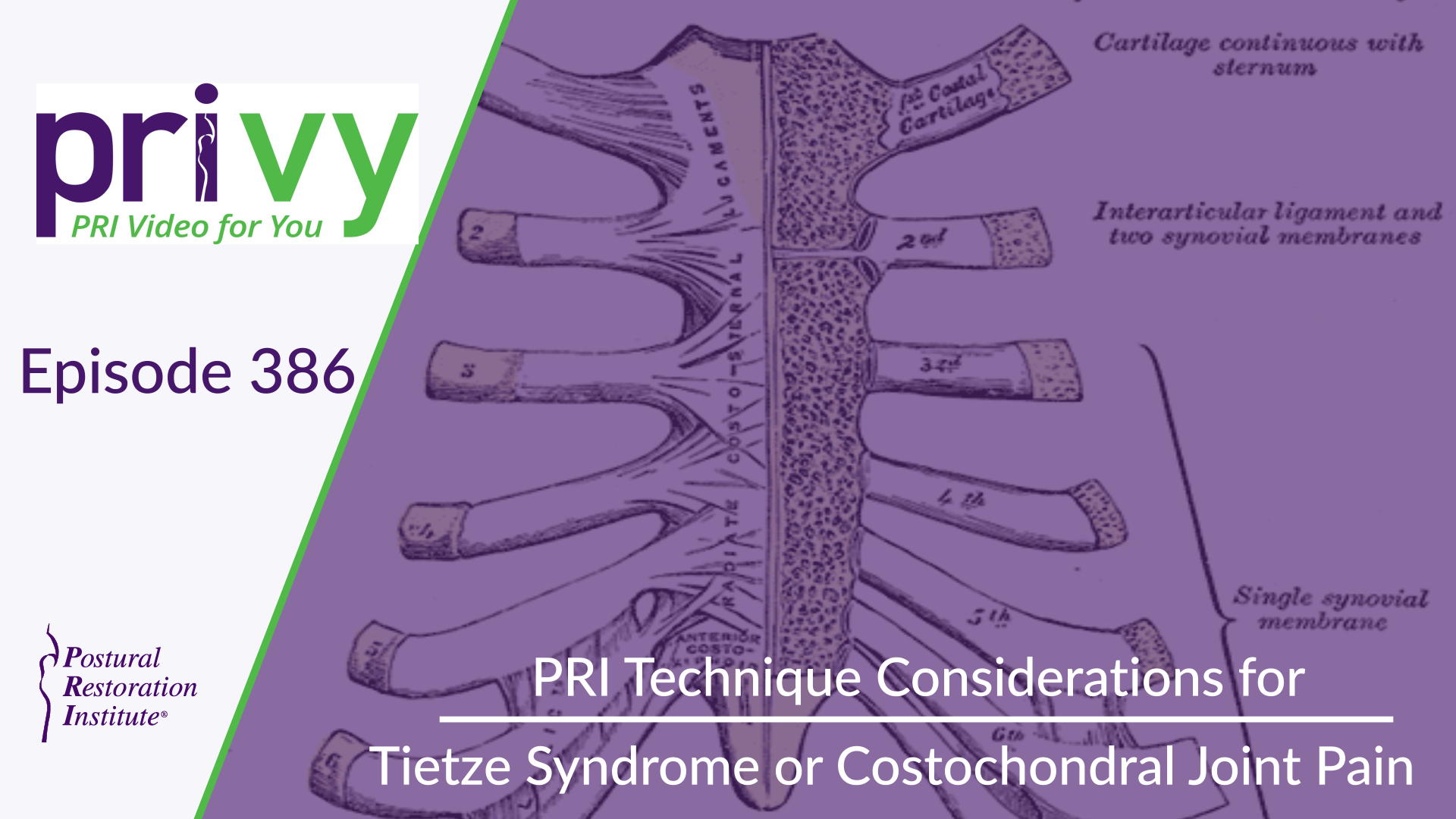 Ep. 386 - PRI Technique Considerations for Tietze Syndrome or ...